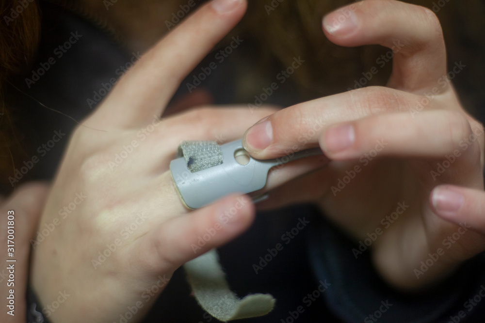 Foto de Applying a bandage to a broken finger. Fixing a broken finger ...