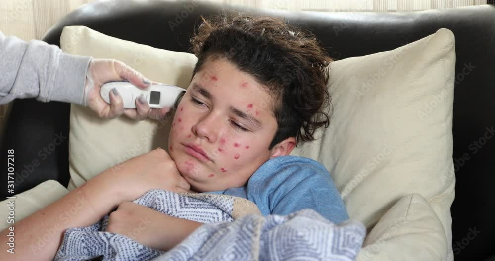 Portrait of a tired young boy suffering from chicken pox rash ...