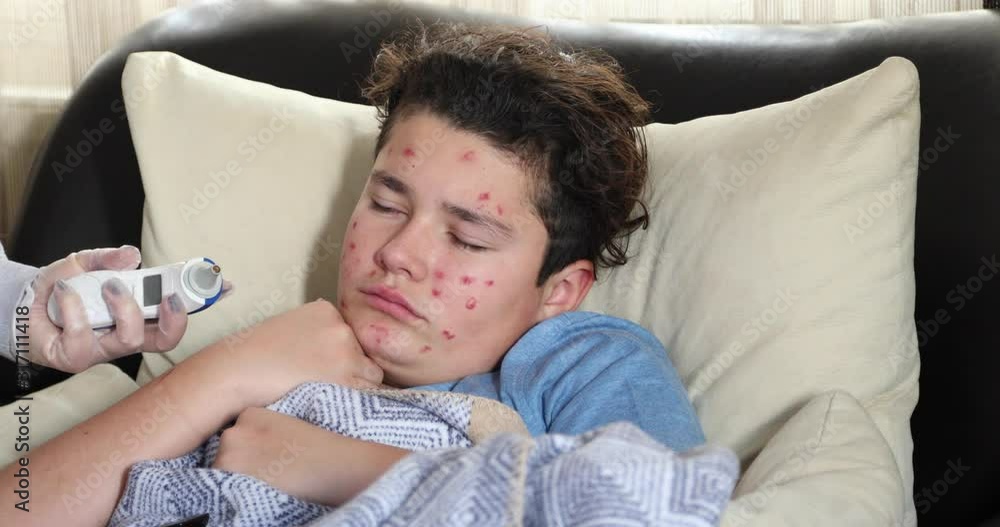 Portrait of a tired young boy suffering from chicken pox rash ...