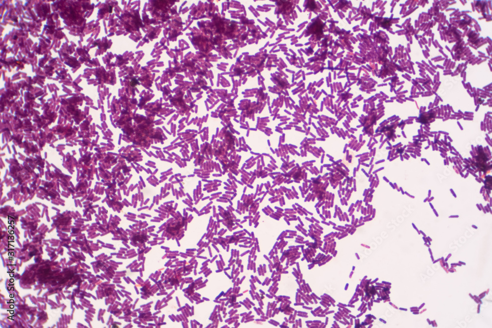 Rod Shaped Bacteria Gram Stain