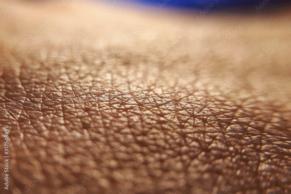 Skin cancer concept. Close up human skin. Macro epidermis texture ...