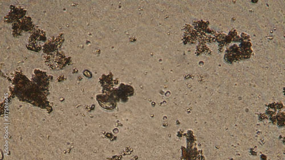 Microscopy of protozoa ciliate and small microorganisms in the water ...