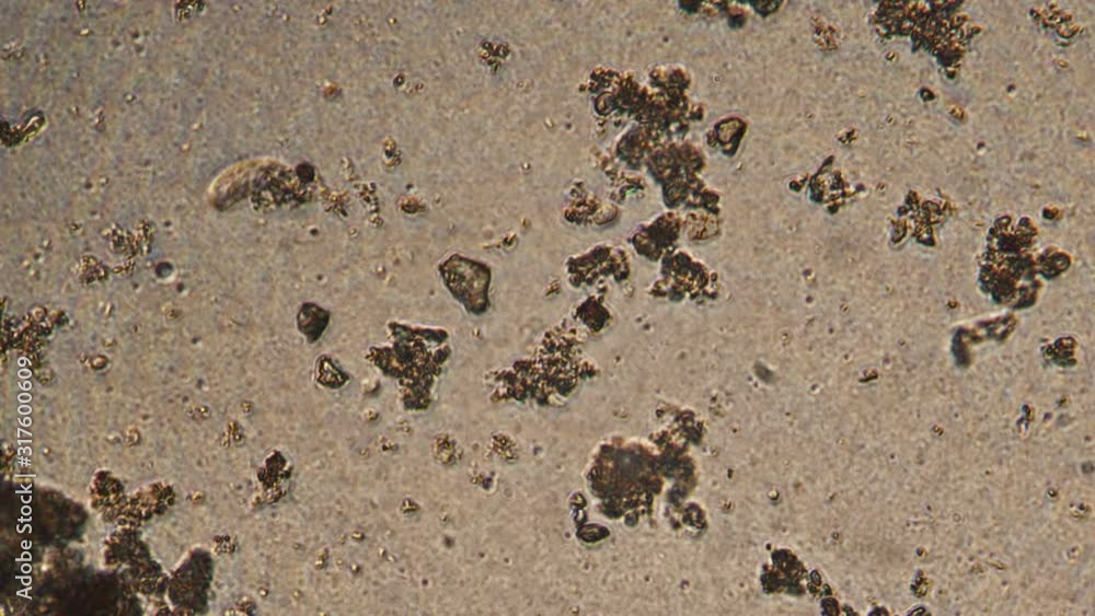 Video „Microscopy of protozoa ciliate and small microorganisms in the ...