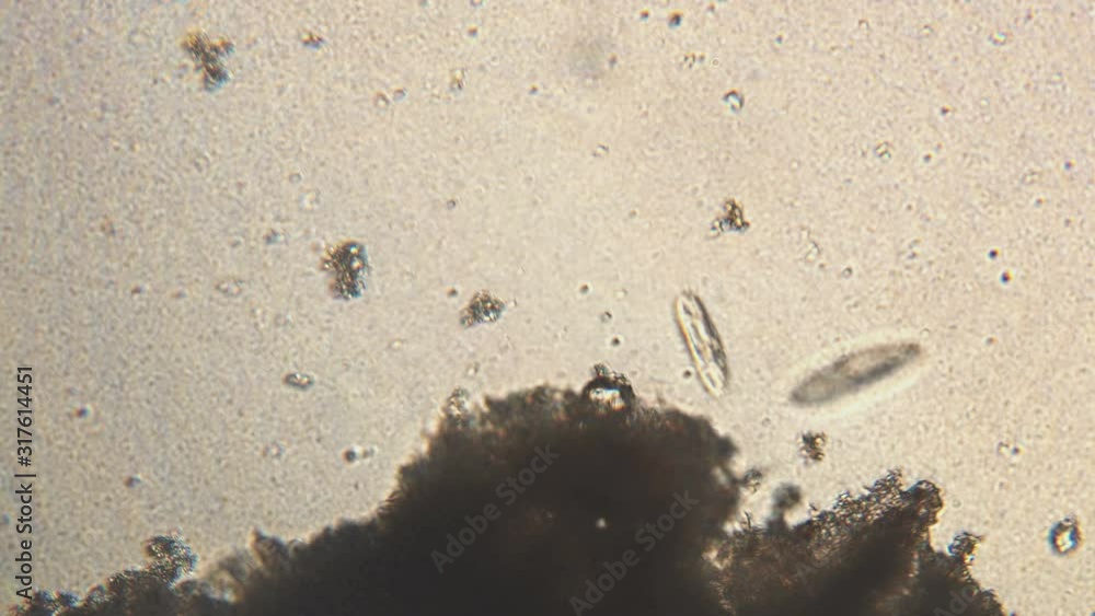 Video „Microscopy of protozoa ciliate and small microorganisms in the ...