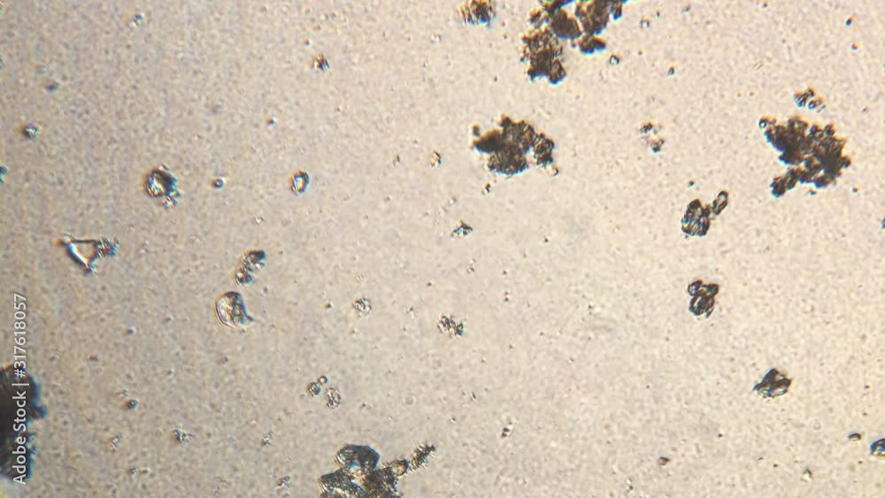 Microscopy of protozoa ciliate and small microorganisms in the water ...