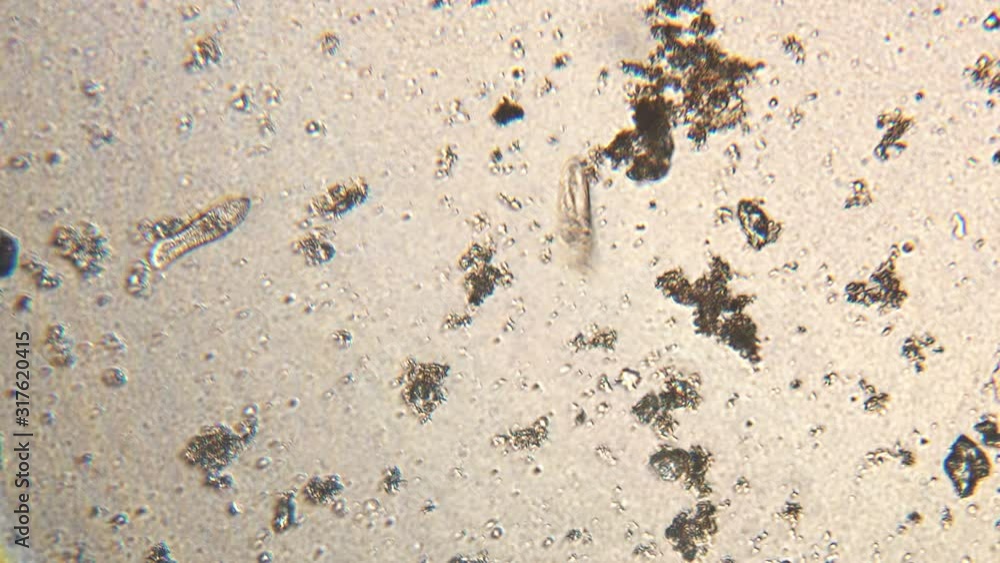 Microscopy of protozoa ciliate and small microorganisms in the water ...
