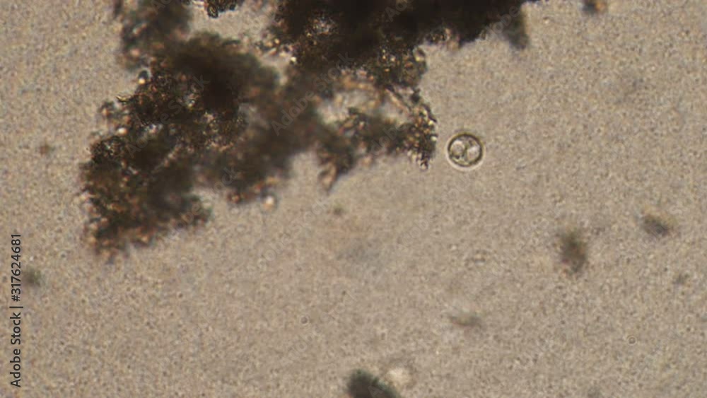 Microscopy of protozoa ciliate and small microorganisms in the water ...