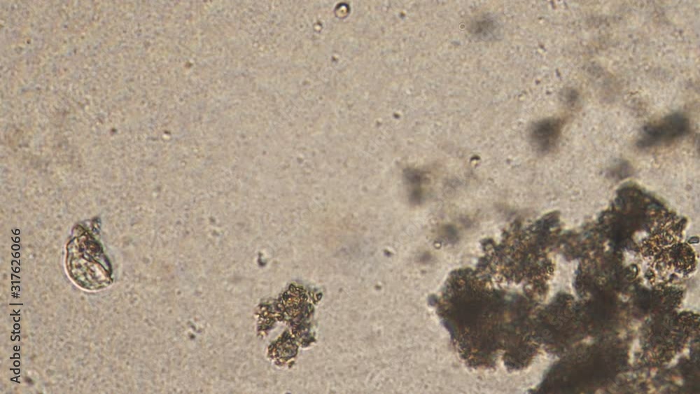 Video „Microscopy of protozoa ciliate and small microorganisms in the ...