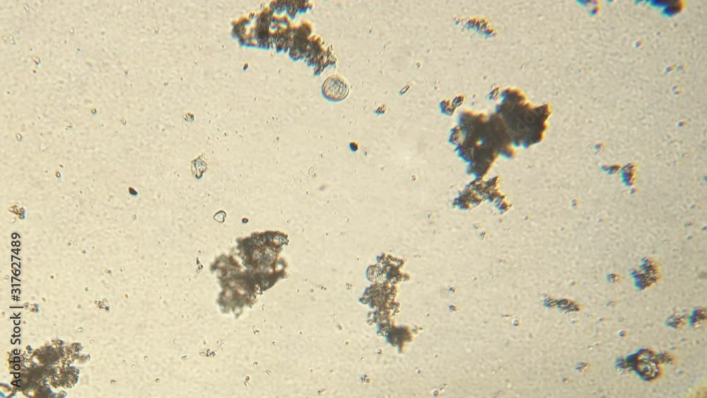 Microscopy of protozoa ciliate and small microorganisms in the water ...