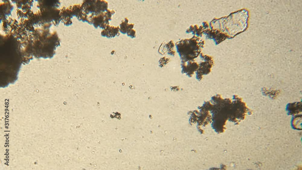 Microscopy of protozoa ciliate and small microorganisms in the water ...
