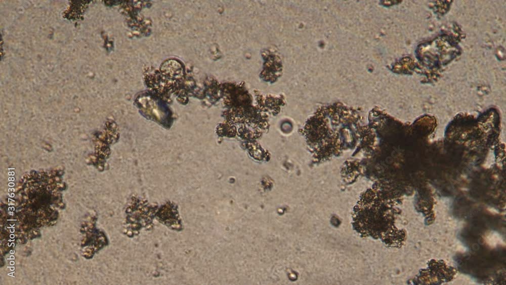 Microscopy of protozoa ciliate and small microorganisms in the water ...