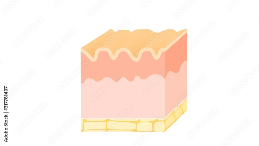 skin aging. difference between the skin of a young and elderly person ...