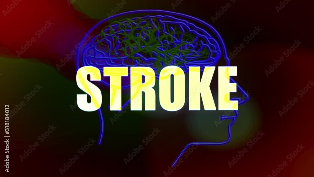 STROKE title intro animated with a background showing a human brain ...