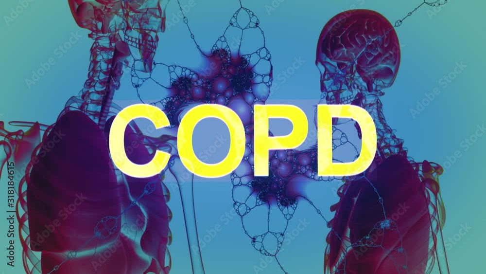 Vídeo do Stock: COPD title intro animated with a colorful background ...
