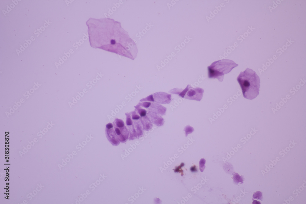 View in microscopic of normal human cervix cells.Glandular epithelium ...