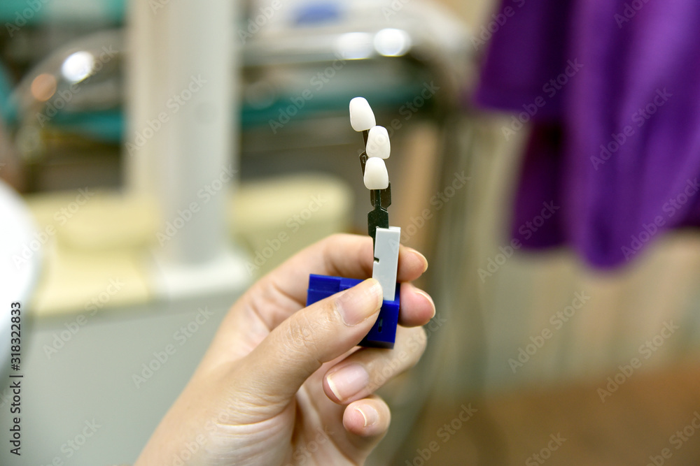 Dental tooth shade guide, Dentist matching color tone of dental chart ...