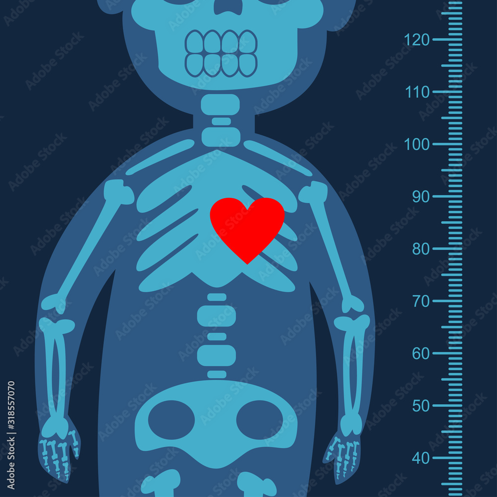 Red cartoon heart on x-ray chest vector illustration. Stock Vector ...