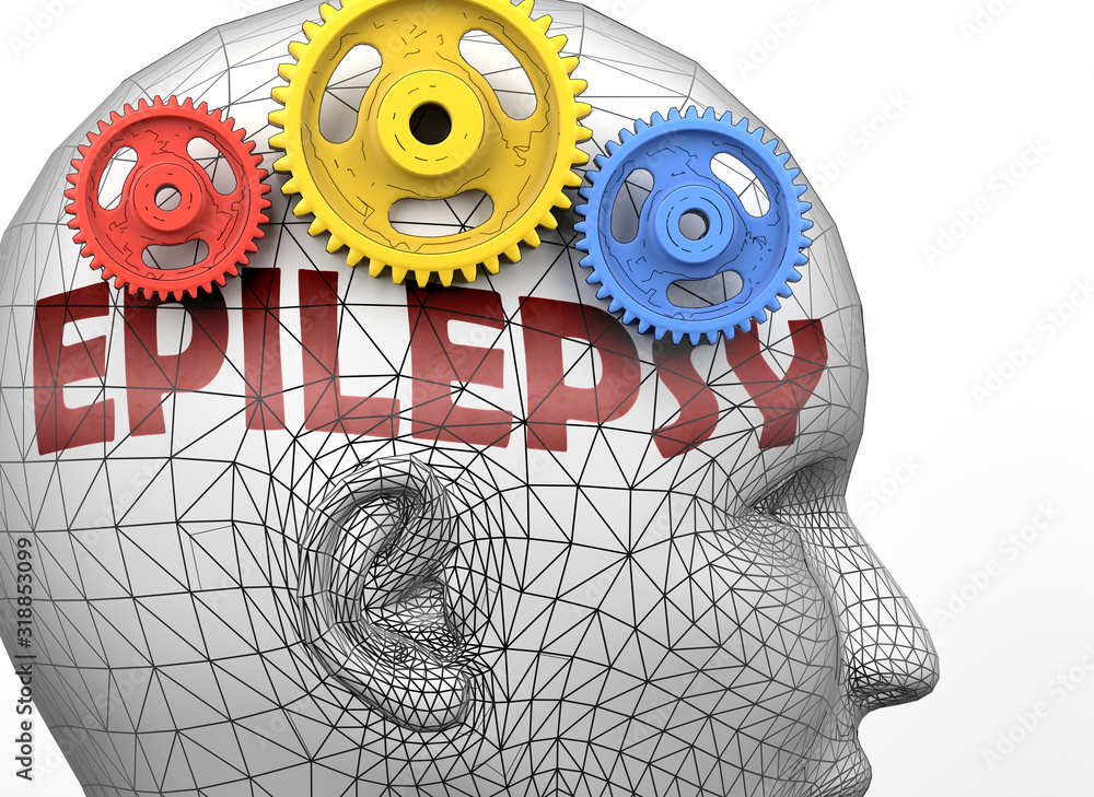 Epilepsy and human mind - pictured as word Epilepsy inside a head to ...