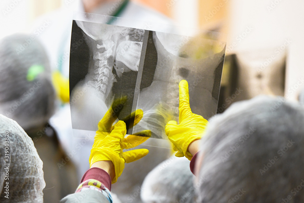 X-ray photograph in the hands. The child is holding an x-ray in his ...