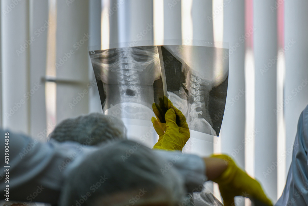 X-ray photograph in the hands. The child is holding an x-ray in his ...