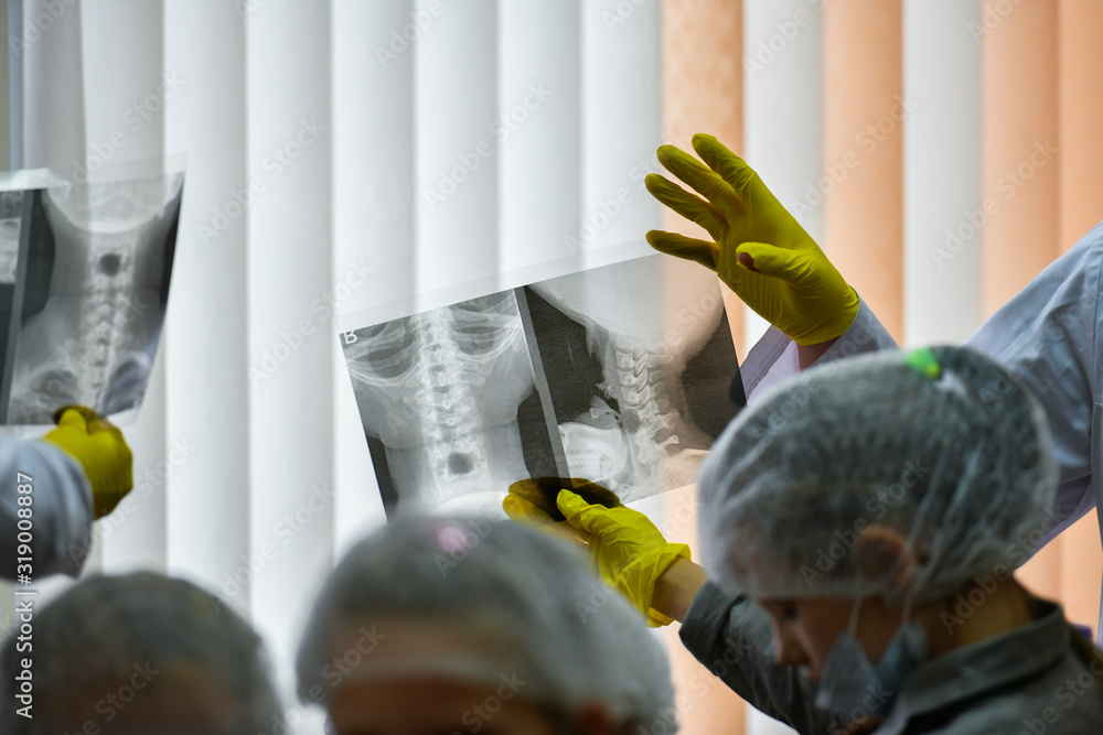 X-ray photograph in the hands. The child is holding an x-ray in his ...