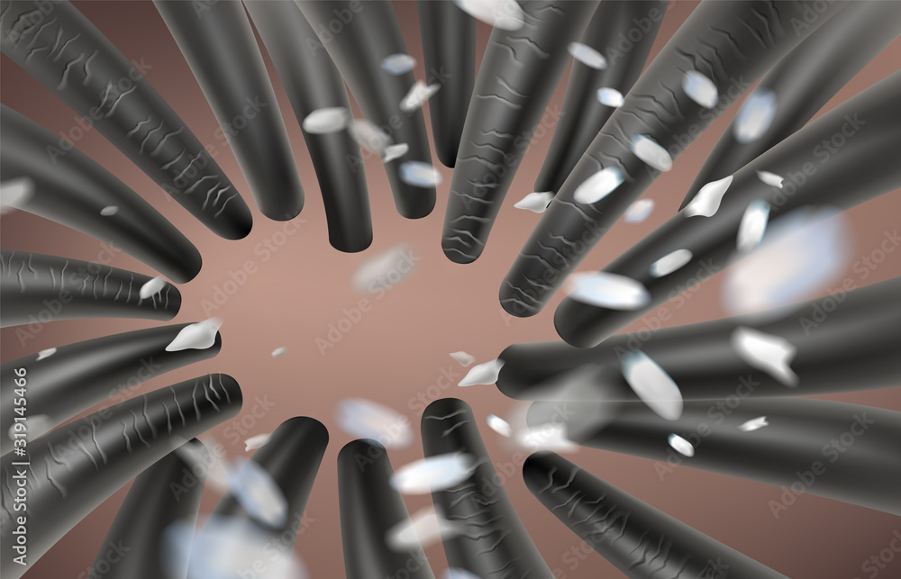 Dandruff and dirt fly on the hair and scalp. Used in the advertisement ...