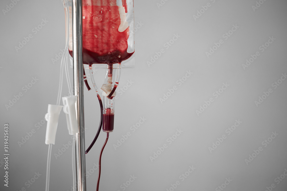 Blood transfusion. Empty bag on stand. Blue background with copy space ...