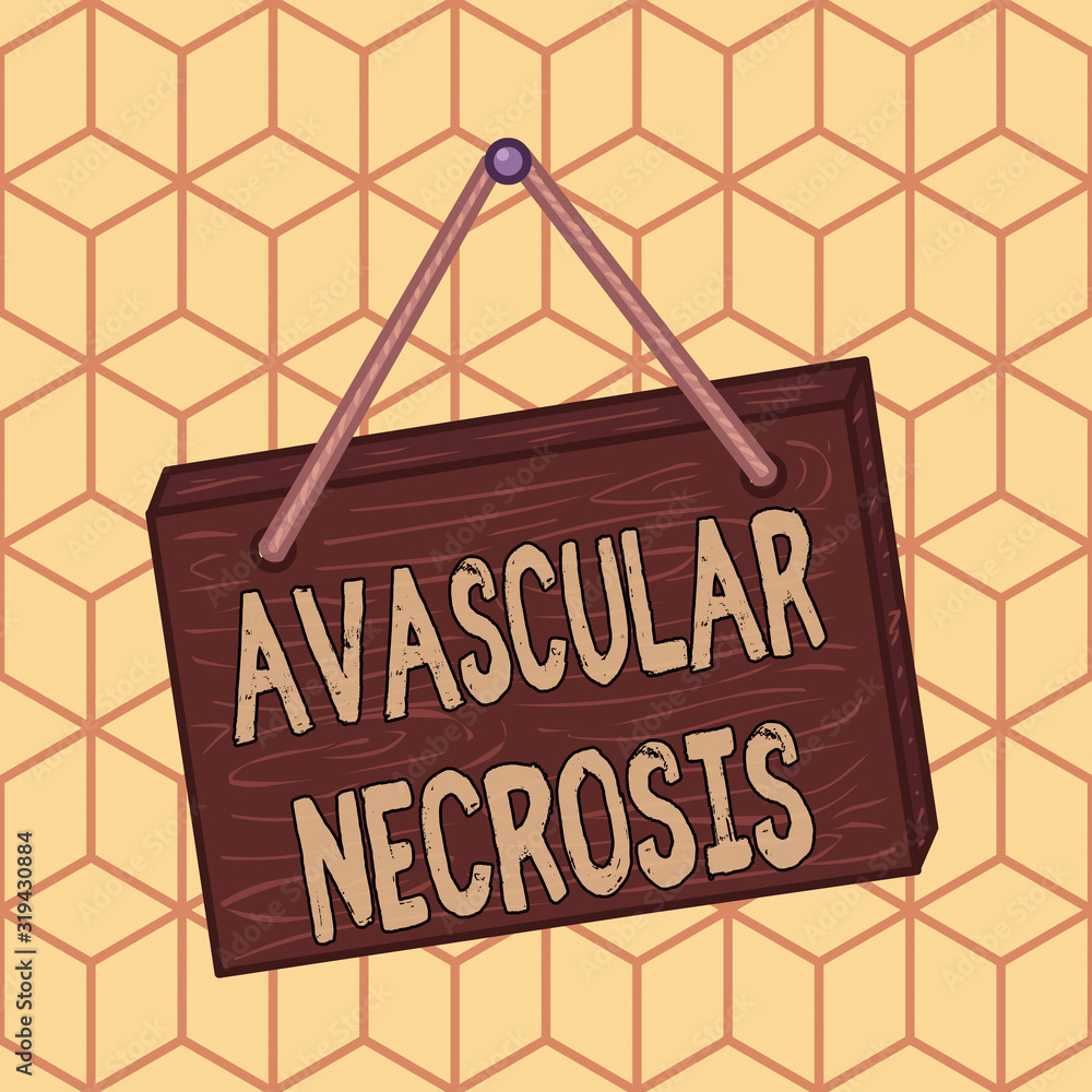 Writing note showing Avascular Necrosis. Business concept for death of ...