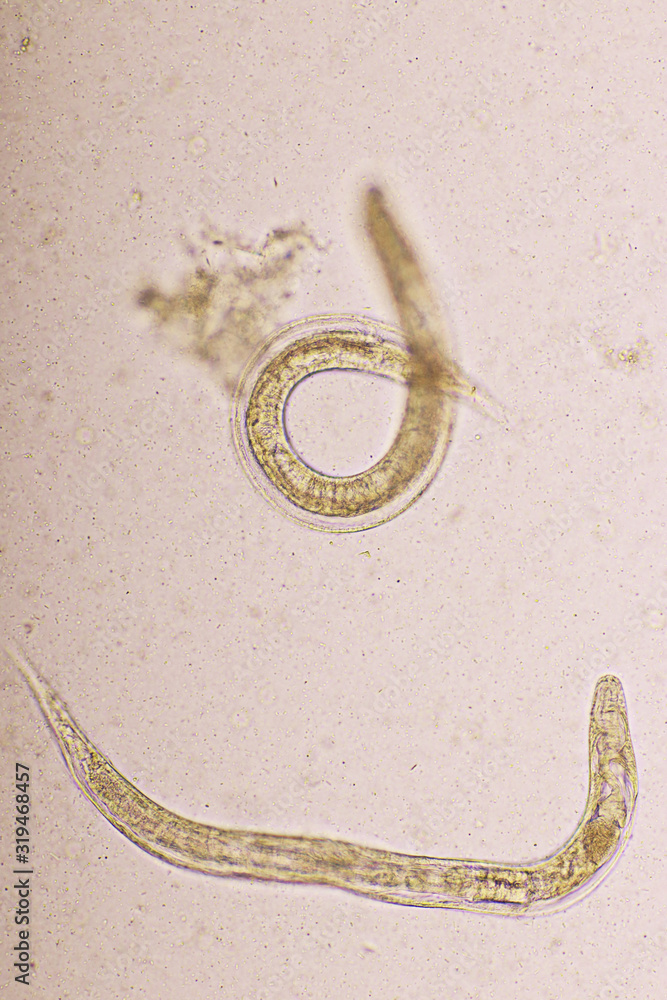 Strongyloides stercoralis or threadworm in human stool, analyze by ...