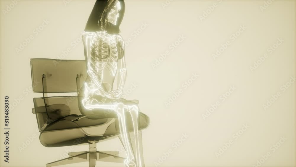 human skeleton radiography medical scan Stock Video | Adobe Stock