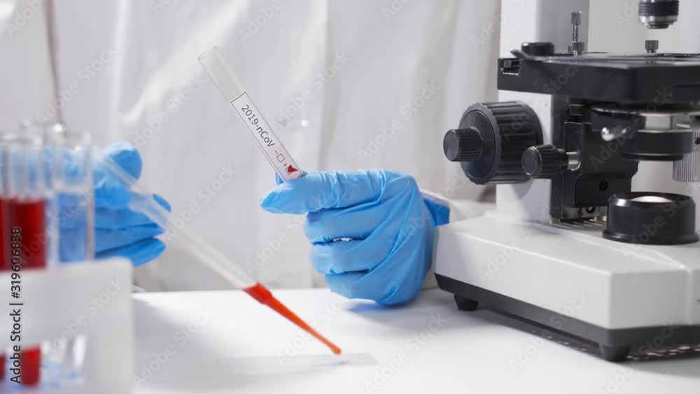 A scientist in the laboratory uses a microscope to study a blood test ...