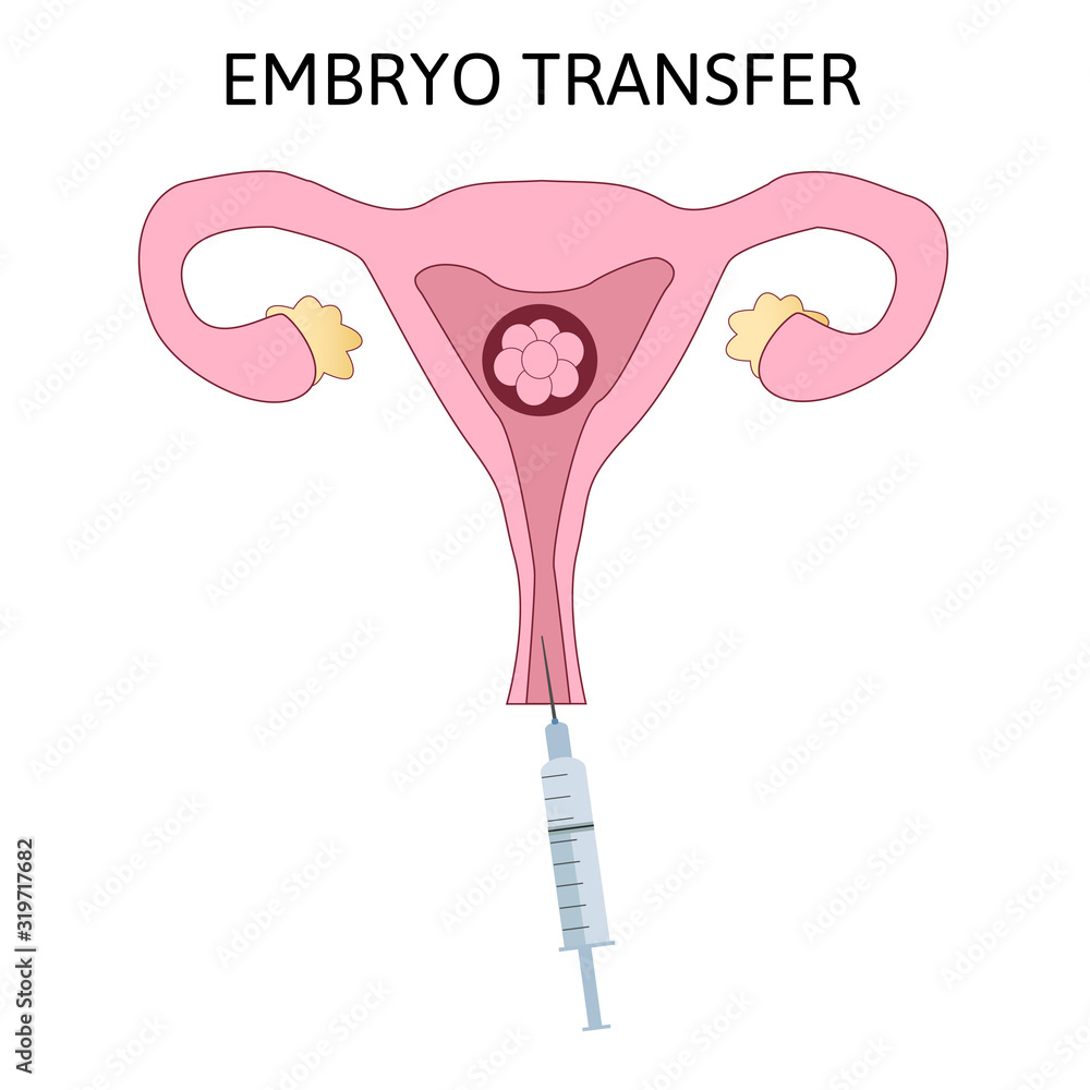 Uterus and ovum embryo transfer artificial insemination isolated female ...