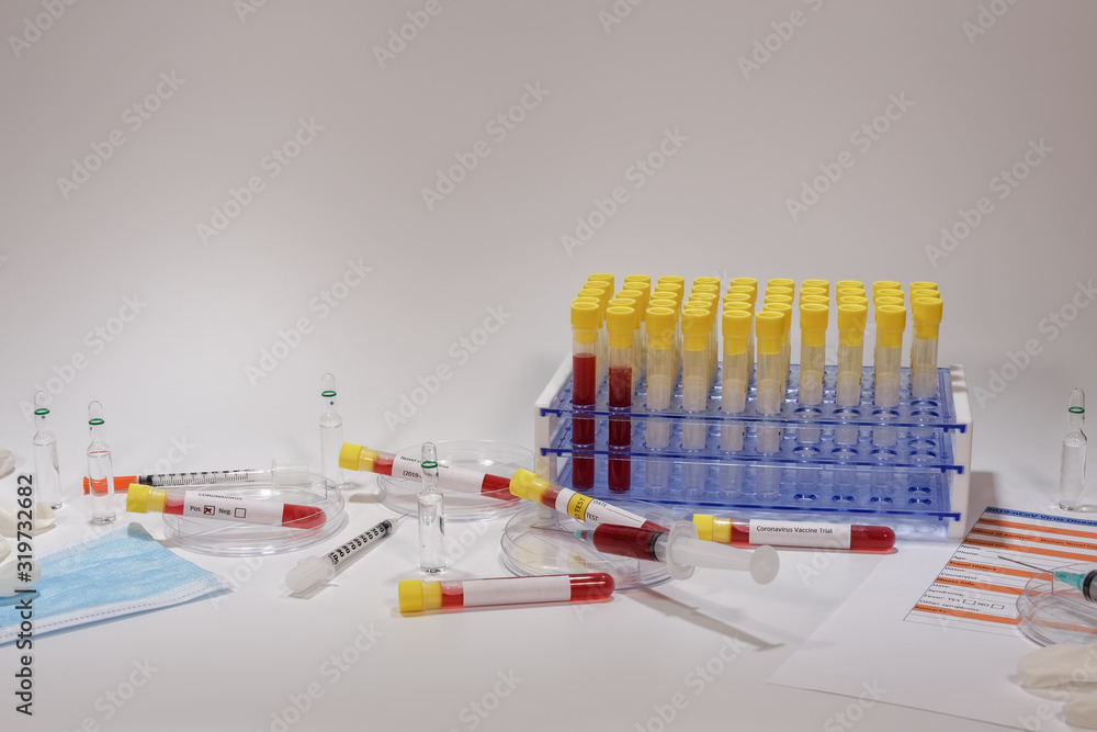 Zdjęcie Stock: Coronavirus COVID-19 2019-nCoV world outbreak tests on ...