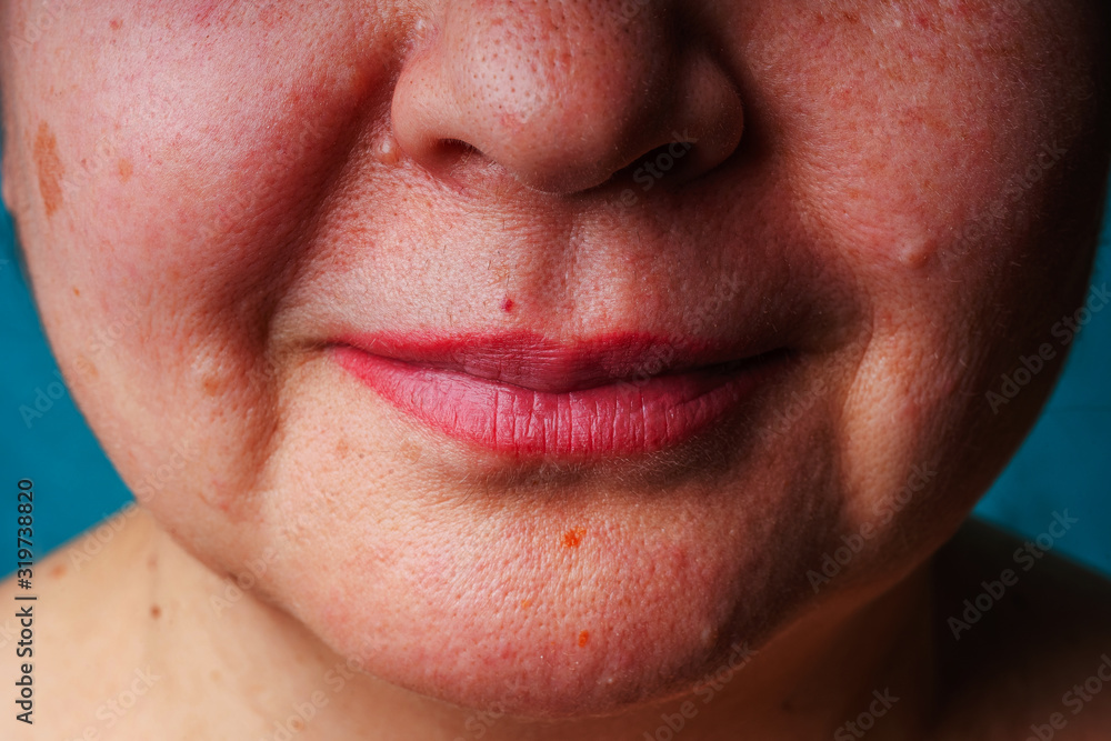 Female lips of an elderly woman close-up. Lips with tattooing. Age ...