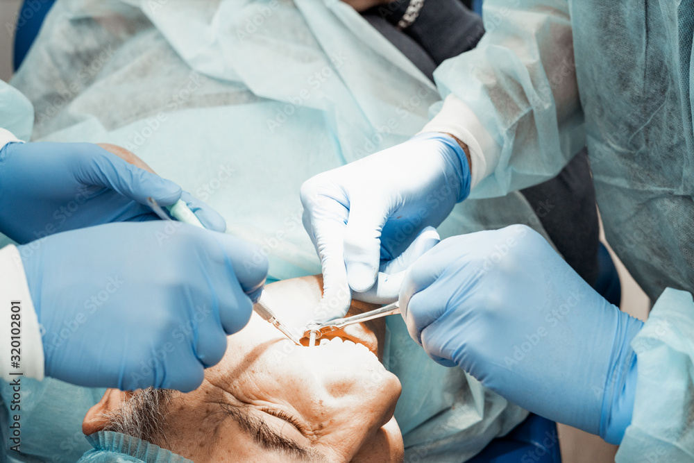 Dentists will perform an operation, implant placement. Real operation ...