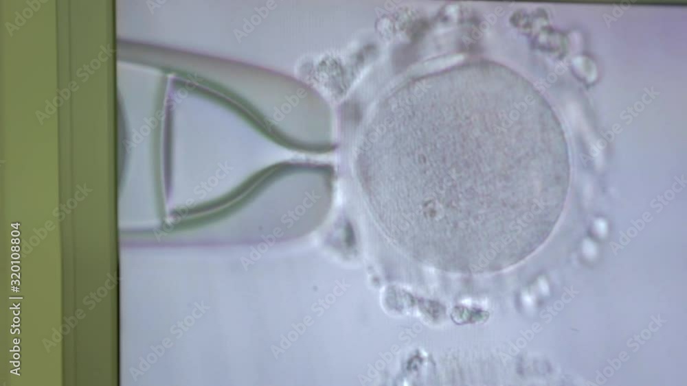 Close-up of monitor in an eco medical center, egg is fertilized with ...