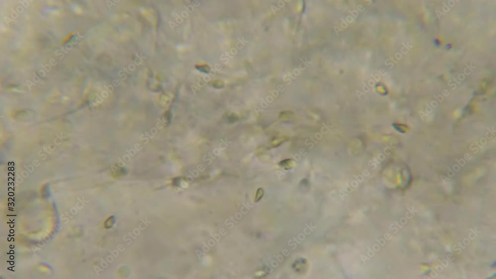 Moving Human Sperm Under Phase Contrast Microscope Sperm Spermatozoa