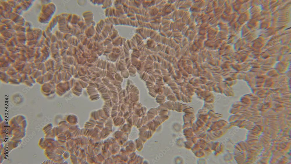 Human Blood, Diseases, Interstitial Fluid, Bacterial Background ...