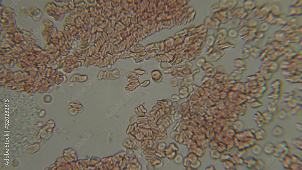 Human Blood, Diseases, Interstitial Fluid, Bacterial Background ...