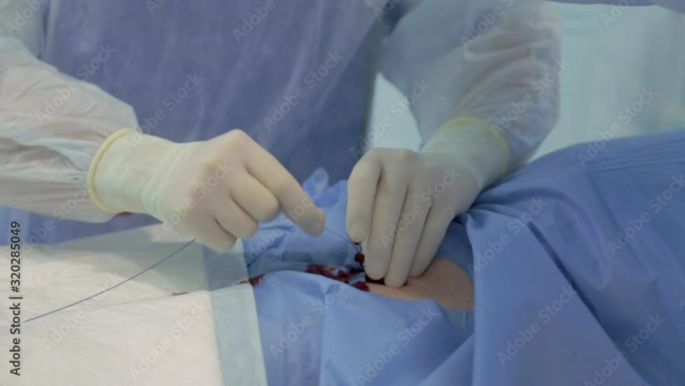 Close-up of doctor’s hands in operating room, doctor starts operation ...