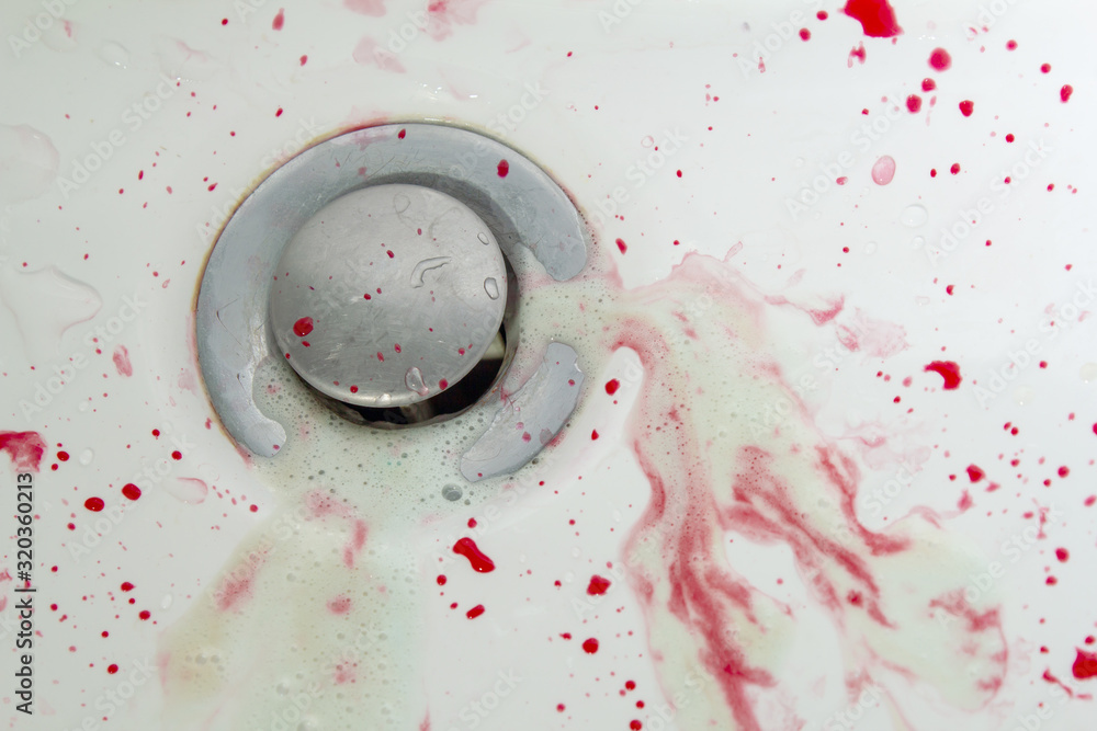 blood in the sink and toothpaste bleed gum copy space. close up Stock ...