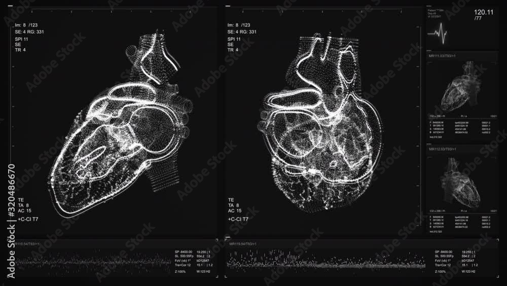 Heart scan screen animation. Blood pressure and heart rate are ...