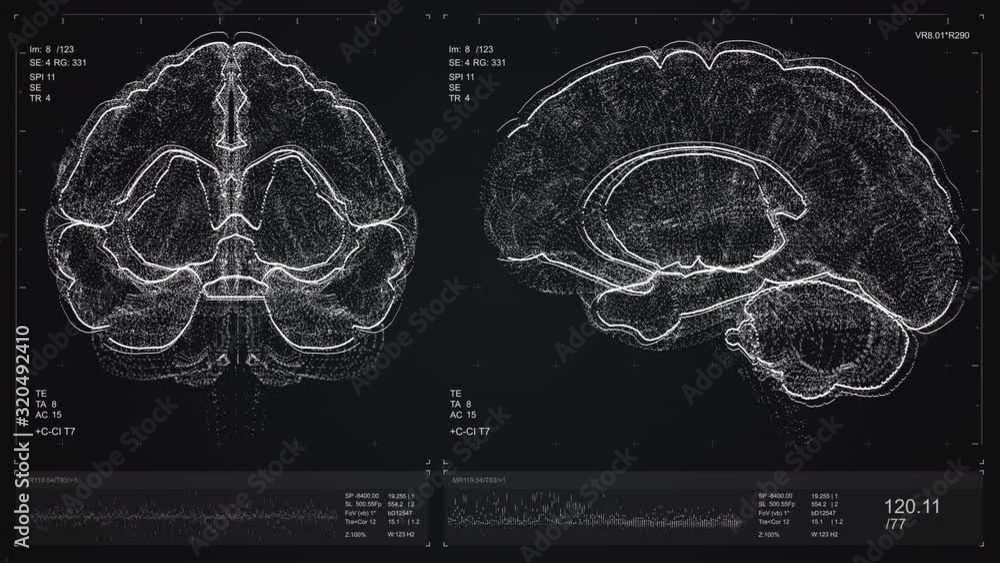 Brain scan screen animation. The device scans and displays vital signs ...