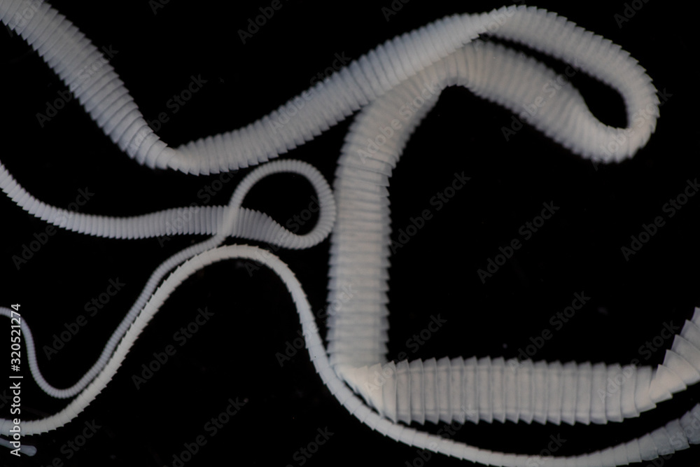 The study of Tapeworm infection is caused by ingesting food or water ...