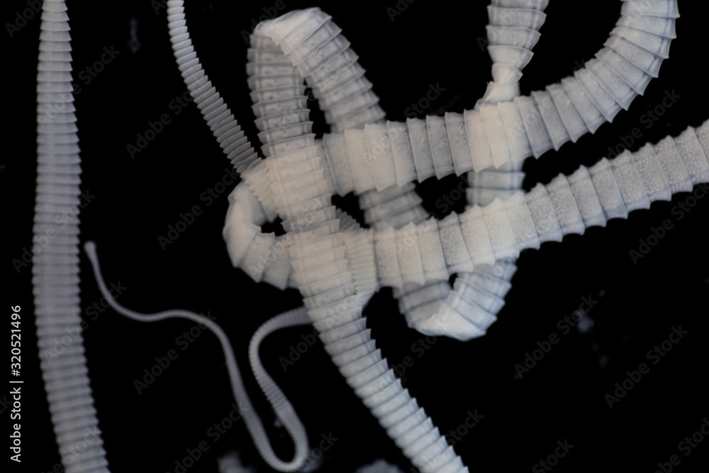 The study of Tapeworm infection is caused by ingesting food or water ...