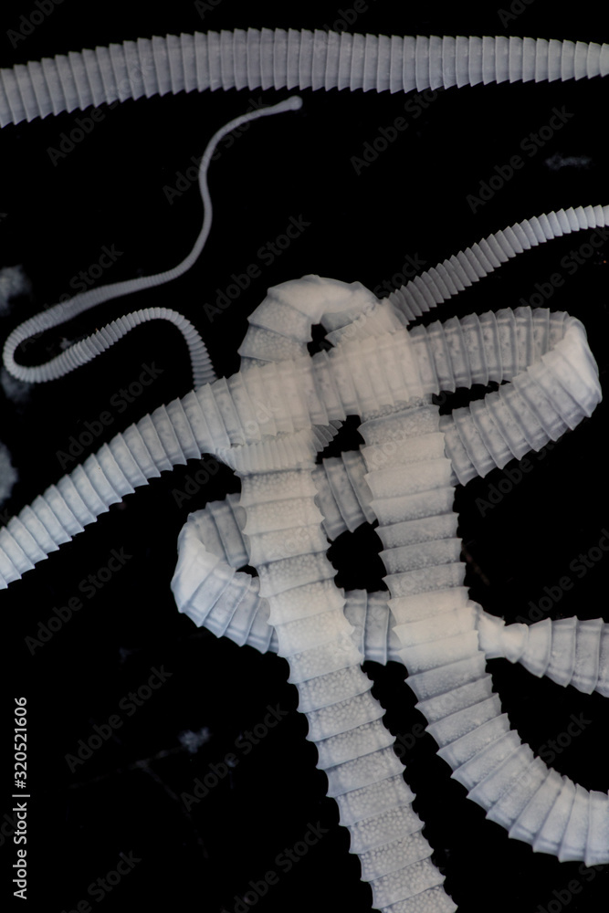 The study of Tapeworm infection is caused by ingesting food or water ...