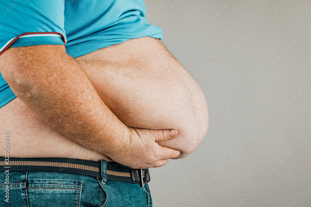 Overweight of a person's body with hands touching the abdomen. The ...