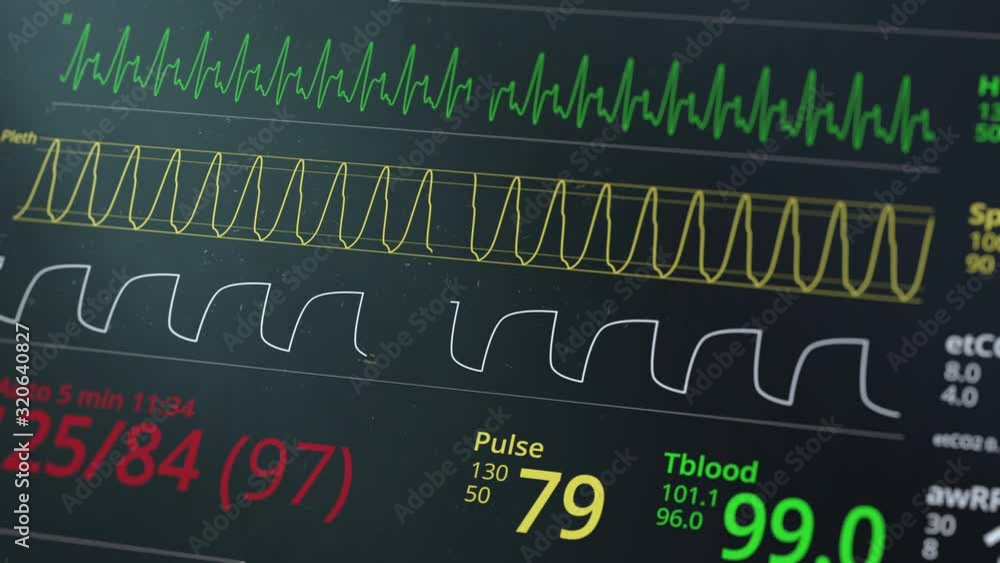 Monitoring vital signs of the patient as heart rate, oxygen saturation ...