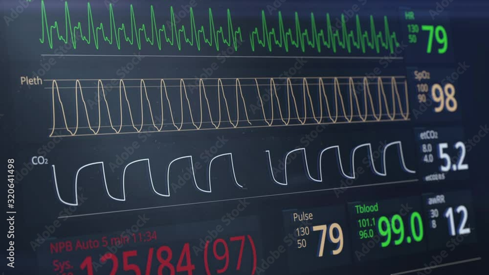 Stockvideon Monitoring patient Vital signs. Heart rate or heart beat ...