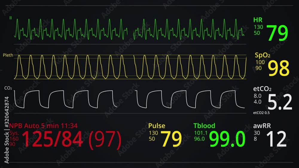 Monitoring patient Vital signs. Heart rate or heart beat, oxygen ...
